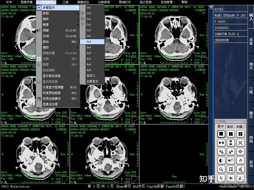 医院pacs系统是什么？ - 知乎
