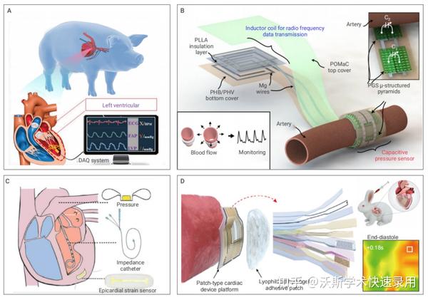 The Innovation | 发表用于心血管健康监测的柔性电子设备的综述 - 知乎