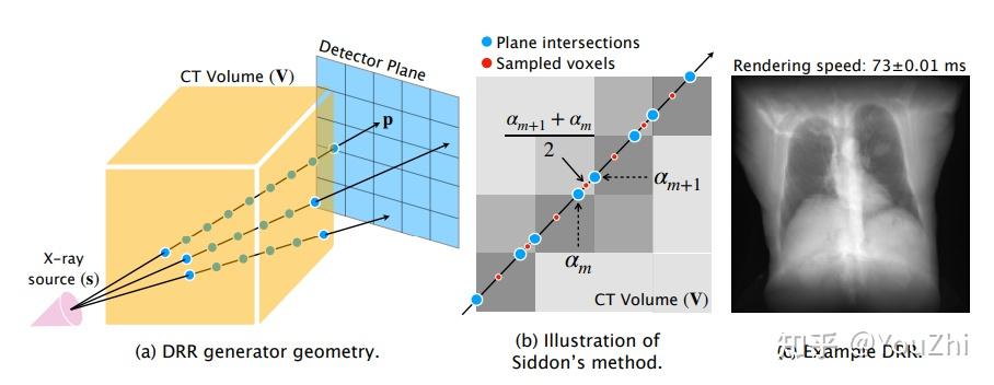 Auto-differentiable DRR(Digitally Reconstructed Radiographs) - 知乎