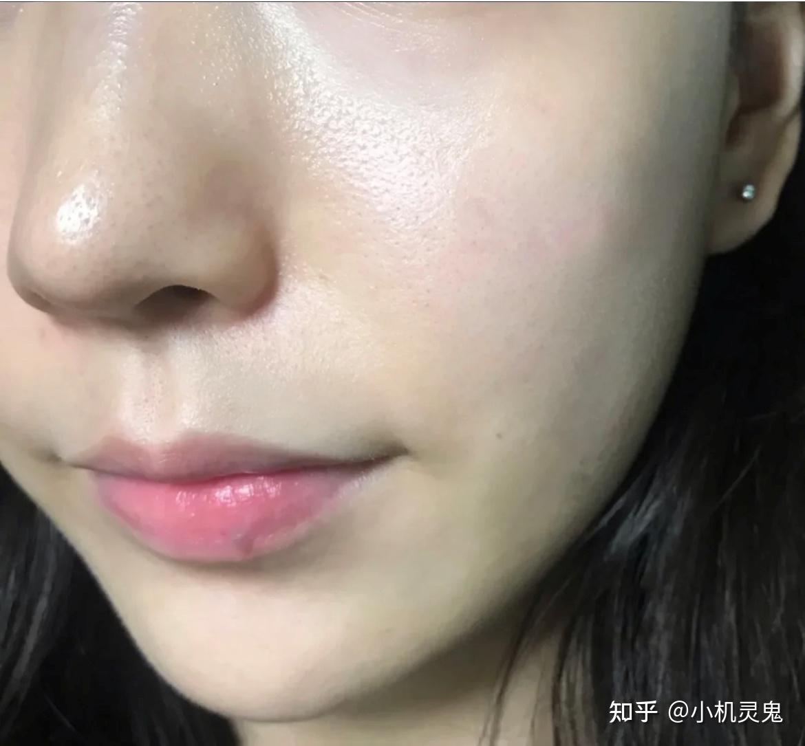 有什么坚持做能让皮肤变好的小习惯 知乎