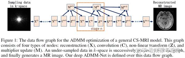 基于模型驱动的深度展开框架1—磁共振成像与自然图像压缩感知分析（ADMM-CSNet） - 知乎