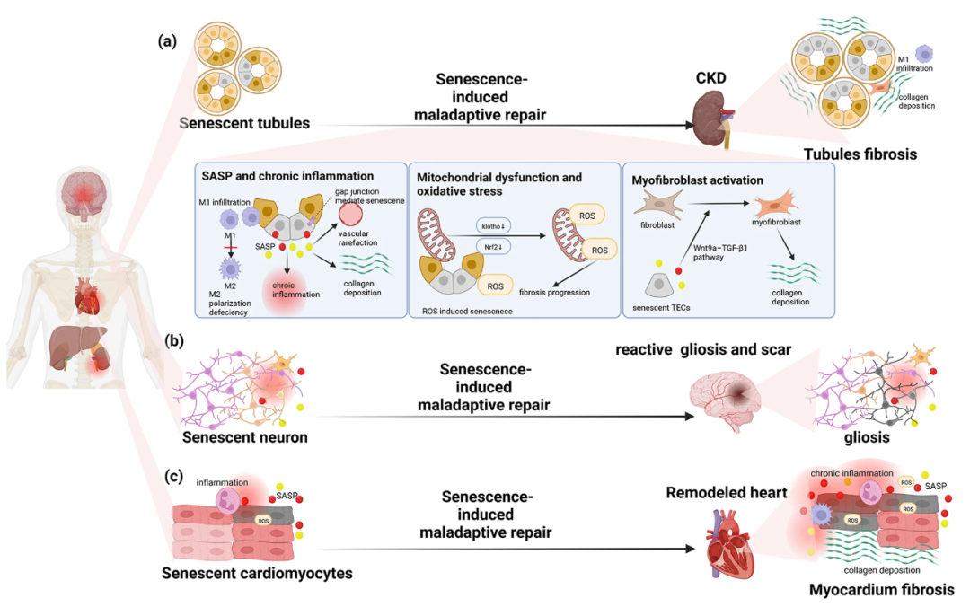 Cell Death Discov 综述︱陈潮金等评述细胞衰老在缺血再灌注损伤中的研究进展 - 知乎