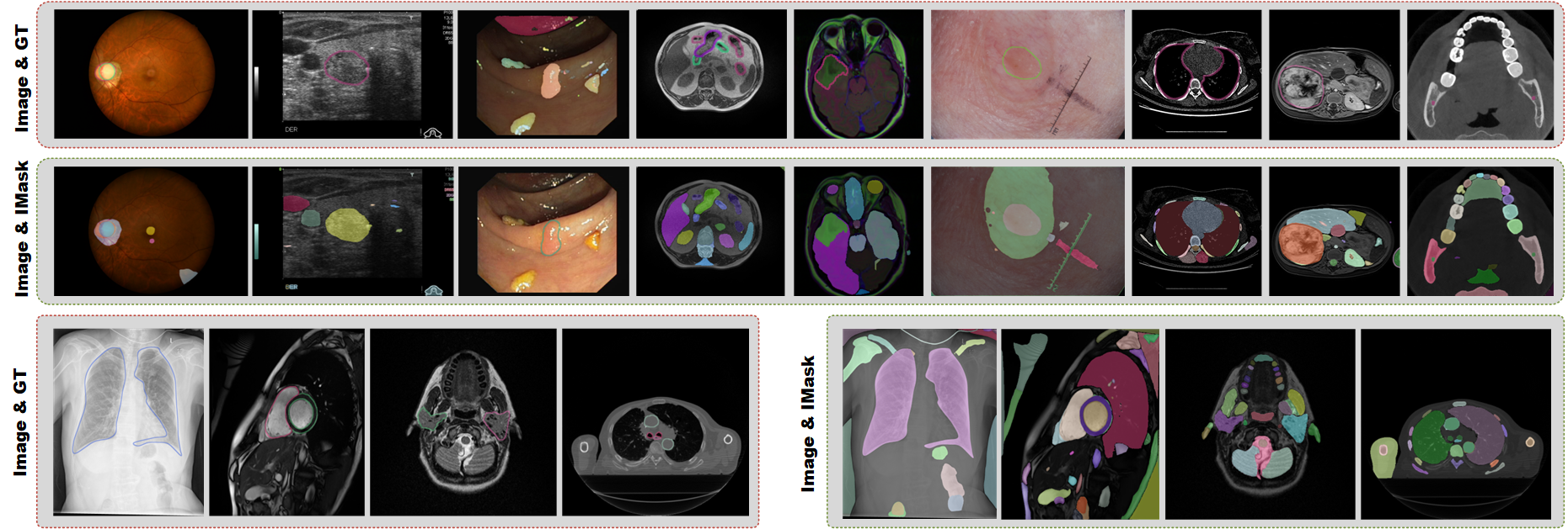 IMIS-Bench：3.61 亿个掩码！开创性交互式医学图像分割基准数据集IMed-361M，重磅发布！ - 知乎