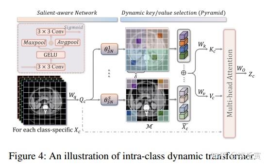 ClassFormer: Exploring Class-Aware Dependency with Transformer for Medical Image Segmentation - 知乎