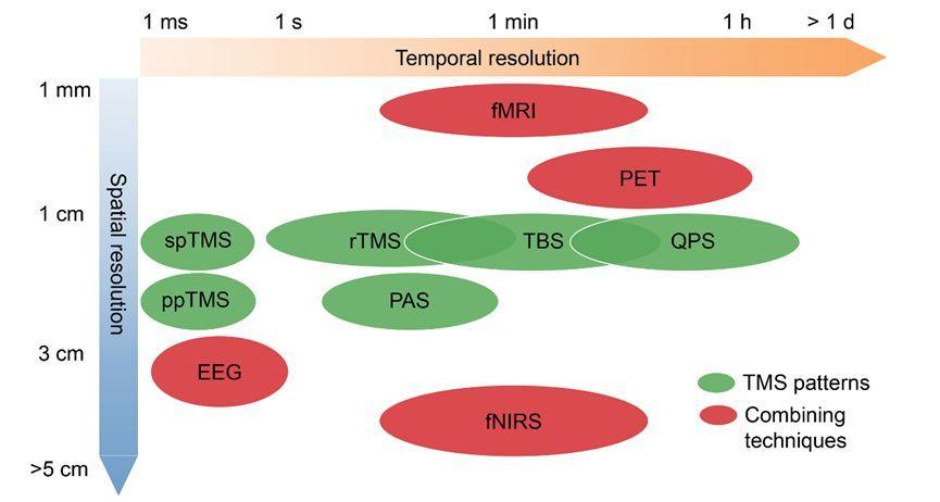 Neurosci Bull封面：蒋田仔团队综述经颅磁刺激精准调控的研究进展 - 知乎
