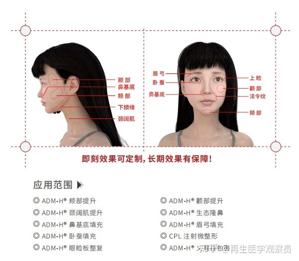 Adm H填充眉弓是用的什么材料? 知乎