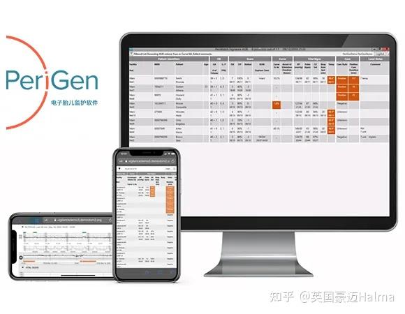 英国豪迈收购PeriGen，拓展智慧医疗评估和监测市场 - 知乎