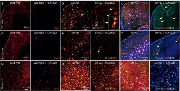 小胶质细胞清除-CSF1R 抑制剂“操纵”小胶质细胞| MedChemExpress - 知乎