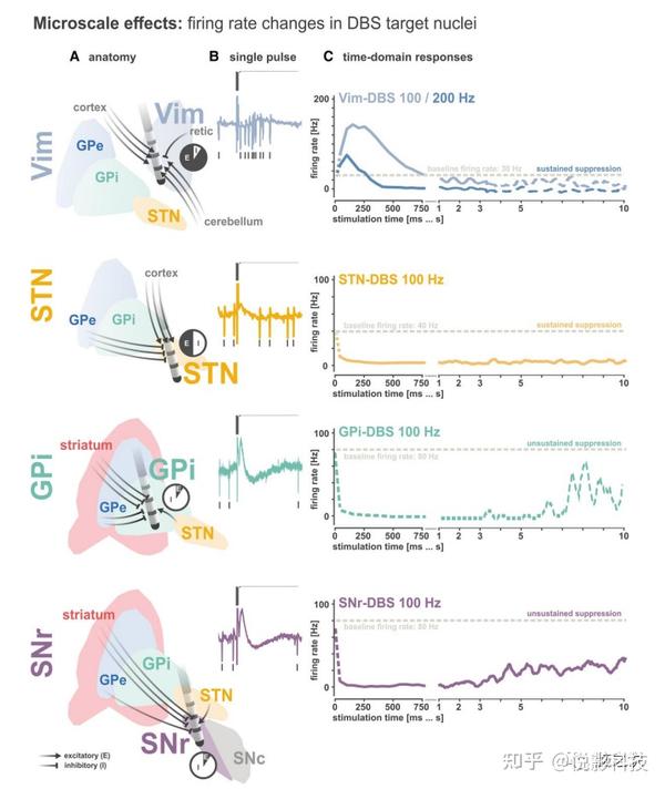 Brain综述：跨时空分辨率的DBS神经生理机制 - 知乎
