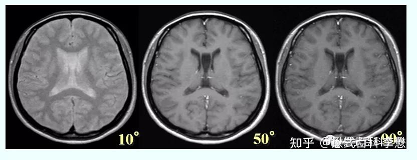 磁共振序列解析之——FFE序列分类 - 知乎