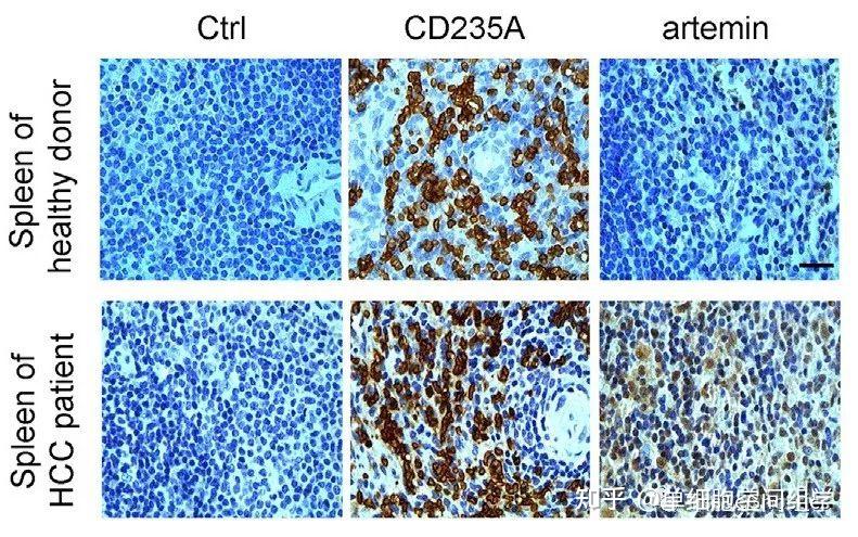 TissueFAXS Cytometry-曹雪涛组潜在药物靶标研发CELL文章分享 - 知乎