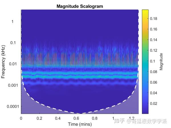 基于深度学习的心电信号（ECG）识别（MATLAB R2021B） - 知乎