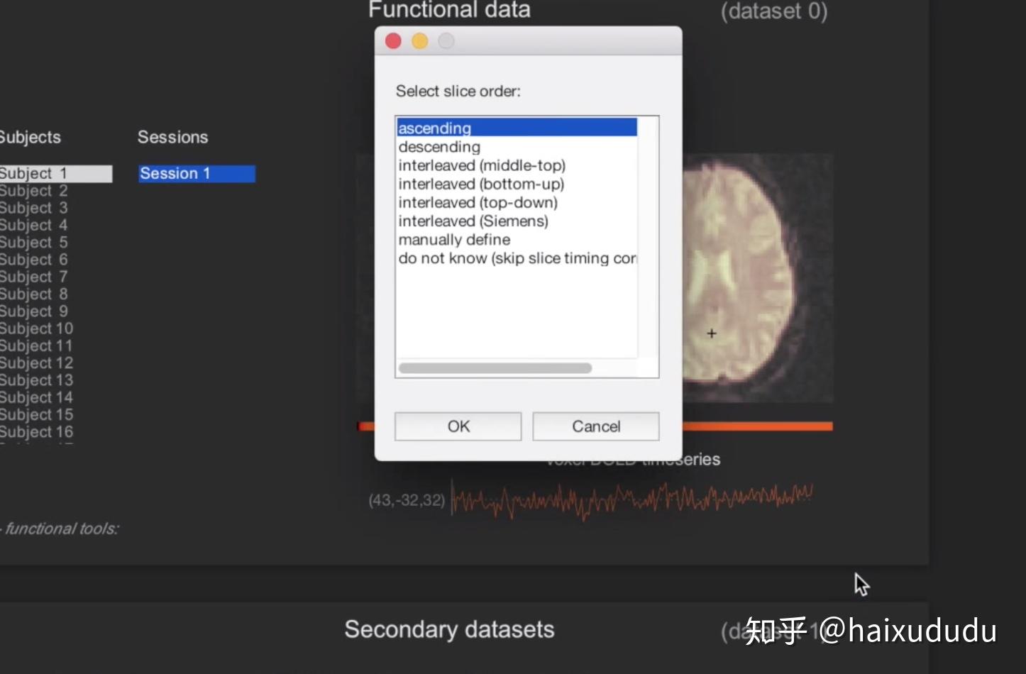 CONN使用总结1 (resting-state fMRI) - 知乎