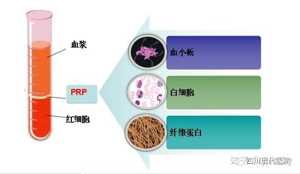 什么是PRP？PRP治疗有什么优势？ - 知乎