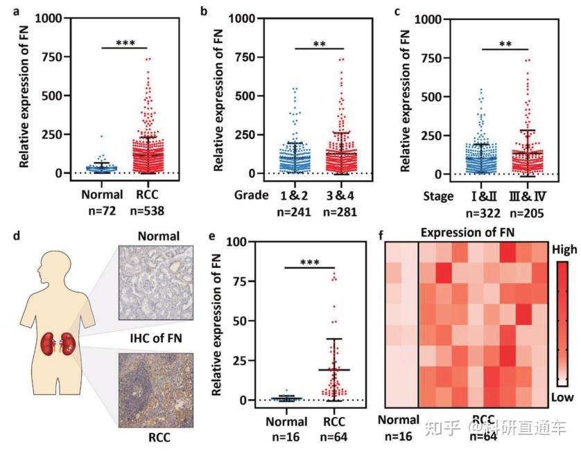 研究前沿｜逆转耐药 提高化疗敏感性！Adv. Mater：可转化的ECM剥夺系统有效抑制肾细胞癌 - 知乎