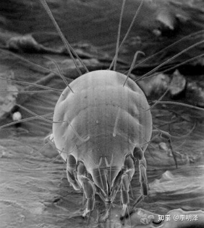 机翻|尘螨 - 知乎