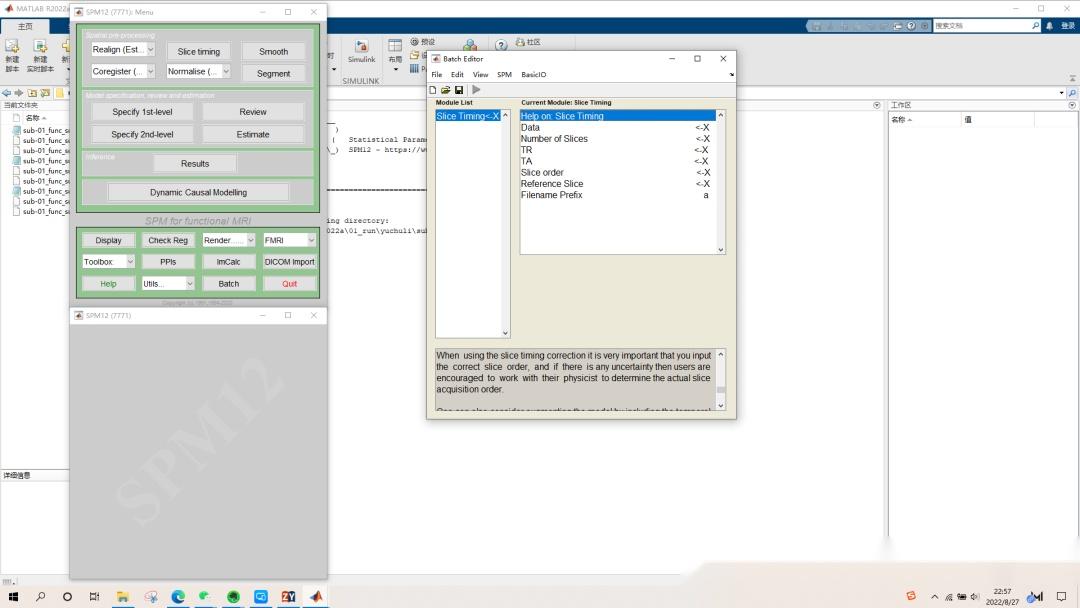 如何用SPM完成fMRI数据的预处理【任务态】 - 知乎
