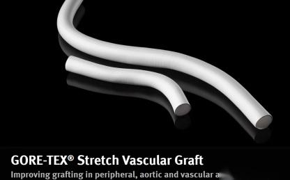 一文盘点人工血管技术与海外产品 - 知乎