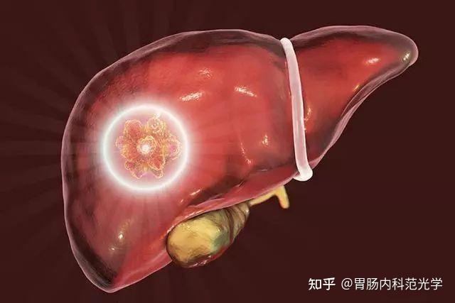 养肝、护肝有什么好方法 知乎