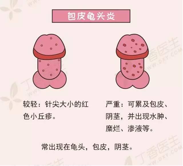 【解惑】丁丁上的小点点,什么东东? 知乎