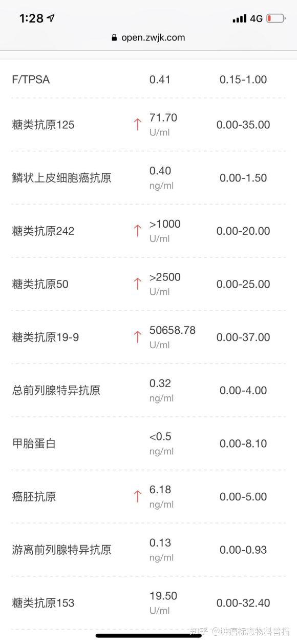 如果CA19-9＞1000，就要引起足够重视了 - 知乎