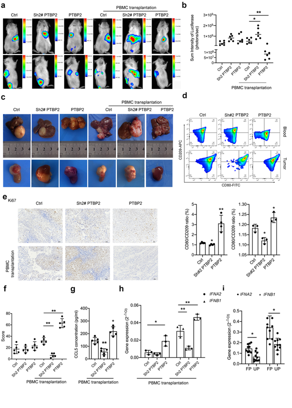 Research︱缪蕾/唐决团队合作揭秘PTBP2调控单核细胞抑制神经母细胞瘤进展的分子机制 - 知乎