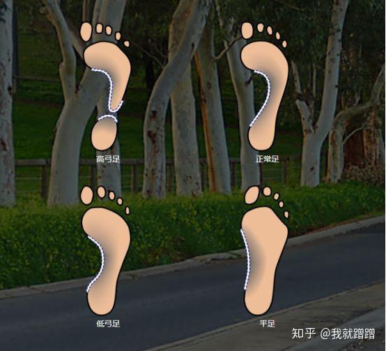 选鞋指导｜缓震型、稳定型、控制型、竞速型跑鞋有哪些区别 | 咕咚文章