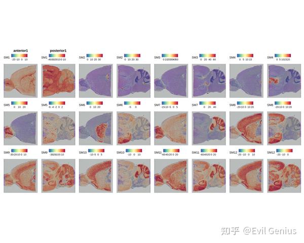针对高维数据（10X单细胞空间）的共表达网络分析（hdWGCNA） - 知乎