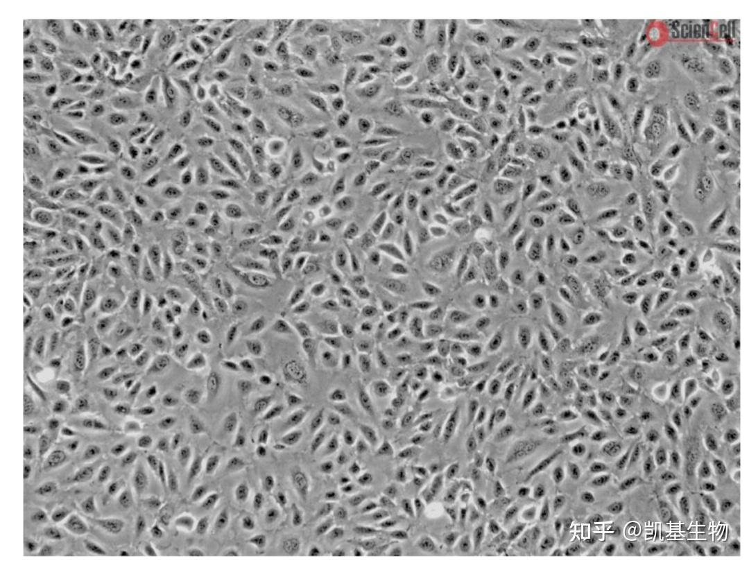 特殊细胞培养——人脐静脉内皮细胞（HUV-EC-C） - 知乎