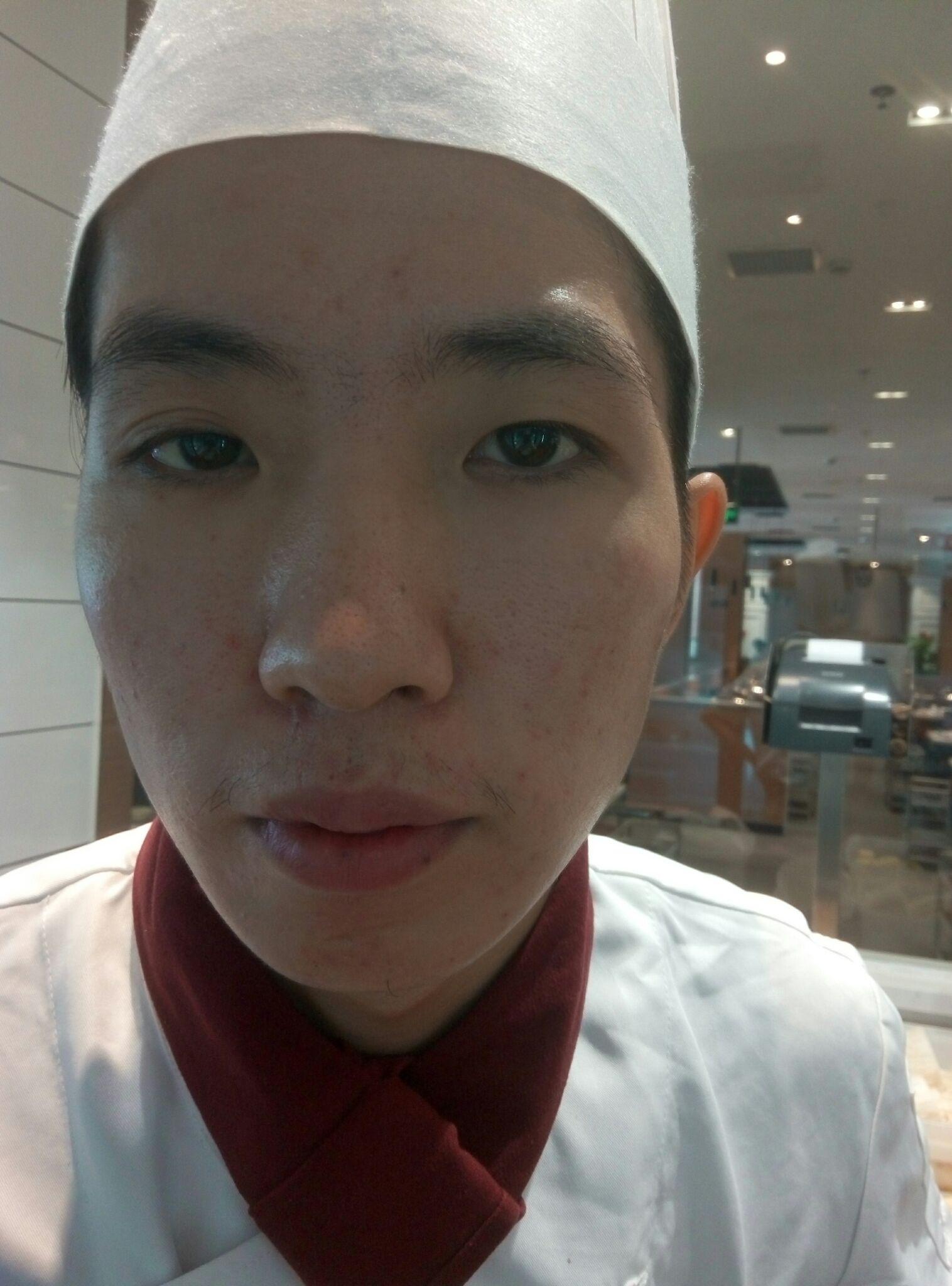怎么根治我的肌肤问题 知乎