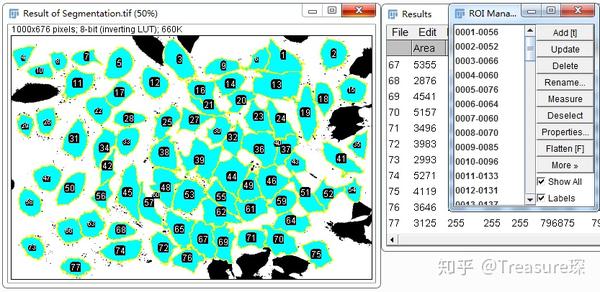 ImageJ实用技巧——不规则细胞分割&计数(解放双手篇) | 斯博利康-细胞生物学液体试剂专家