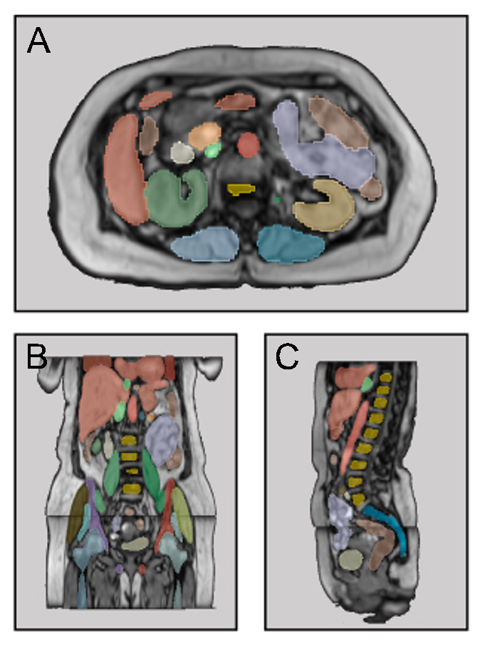 Pipecat：构建语音多模态对话Agent框架开源；基于COYO的500万条图像标注数据集开放；IBM开源其代码模型，推动编程任务更轻松高效；MRI扫描扩展工具开源 - 知乎