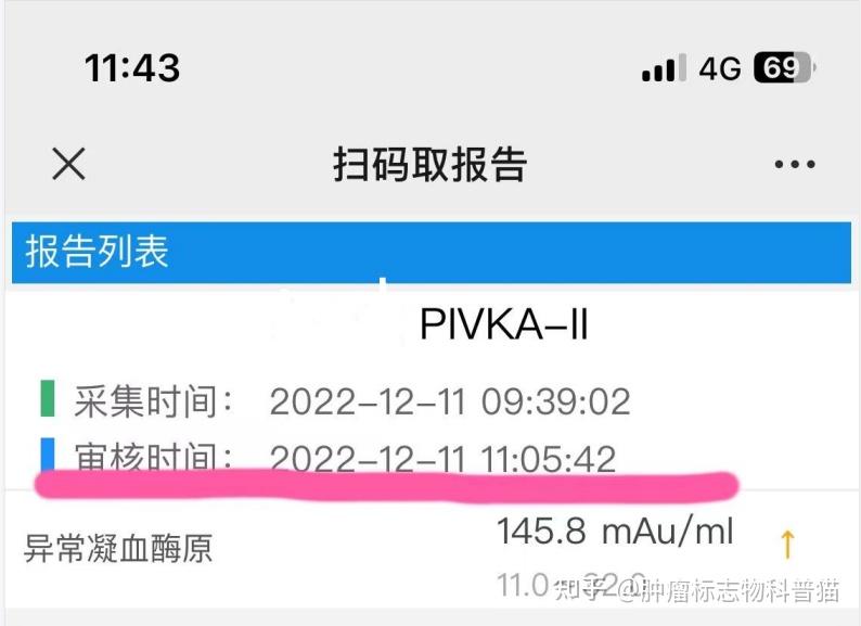 肝癌筛查新指标：异常凝血酶原（PIVKA-II） - 知乎