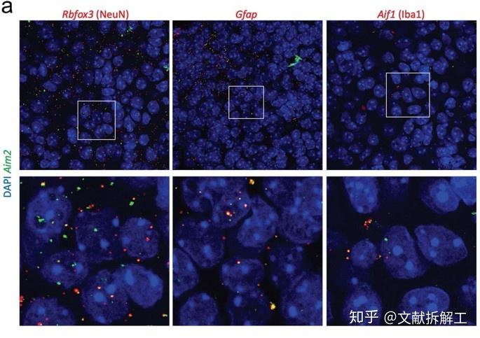 【Nature论文拆解】 AIM2炎症小体通过监视和清除细胞DNA损伤调节神经发育 - 知乎