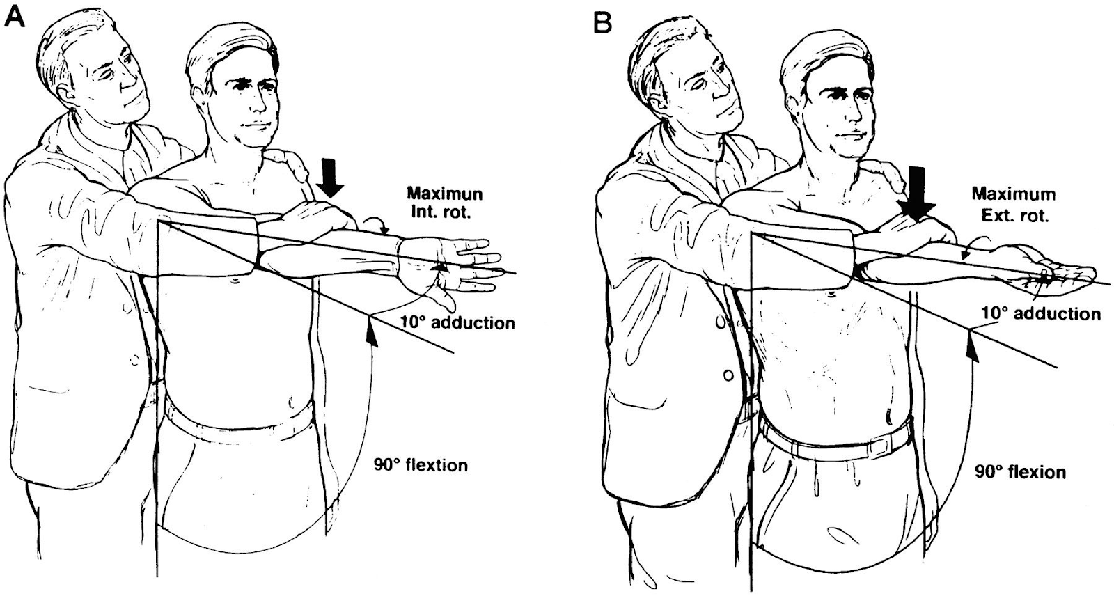 David运动康复系列专题：肩关节上盂唇撕脱损伤（SLAP损伤） - 知乎