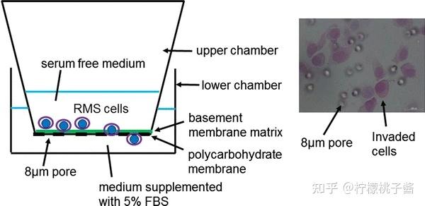 实验技术 | Transwell实验总结（建议收藏） - 知乎