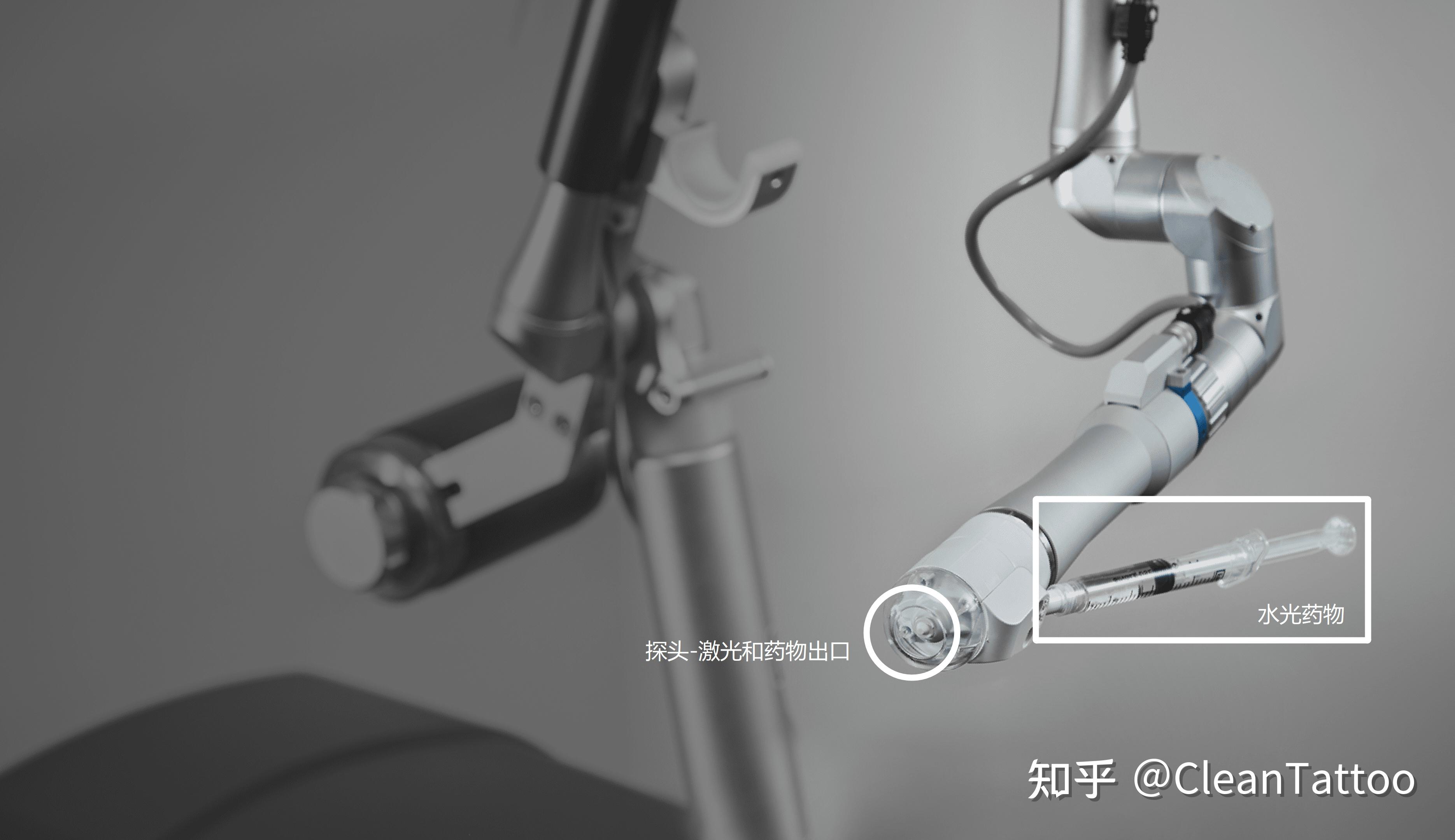 【篇二】Mirajet激光-一个专注激光美肤治疗15年的医生对激光仪器有多执着 - 知乎
