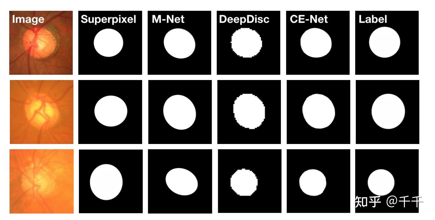 CE-Net: Context Encoder Network for 2D Medical Image Segmentation（译文） CE-Net：用于2D医学图像分割的上下文编码器网络 ...