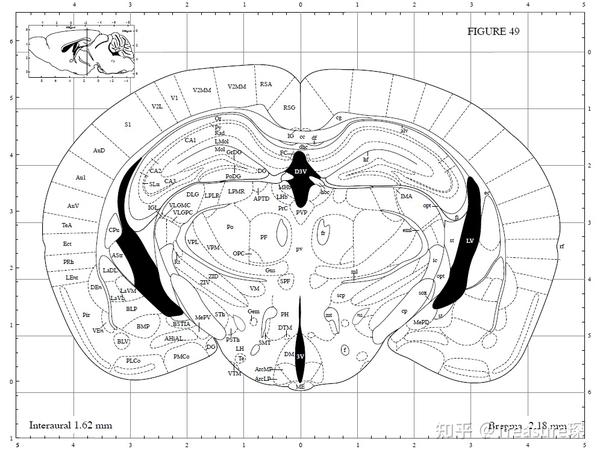 MATLAB科研图像处理——手动脑片图谱配准 - 知乎