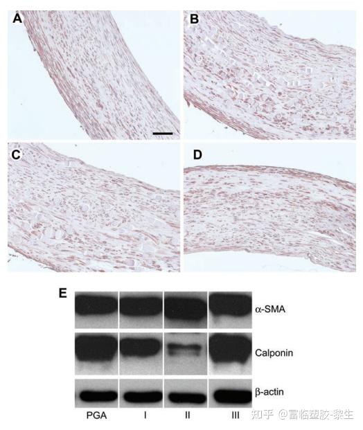 PGA Biofelt植入级无纺布用于血管组织工程的新型可生物降解聚合物支架的开发 - 知乎
