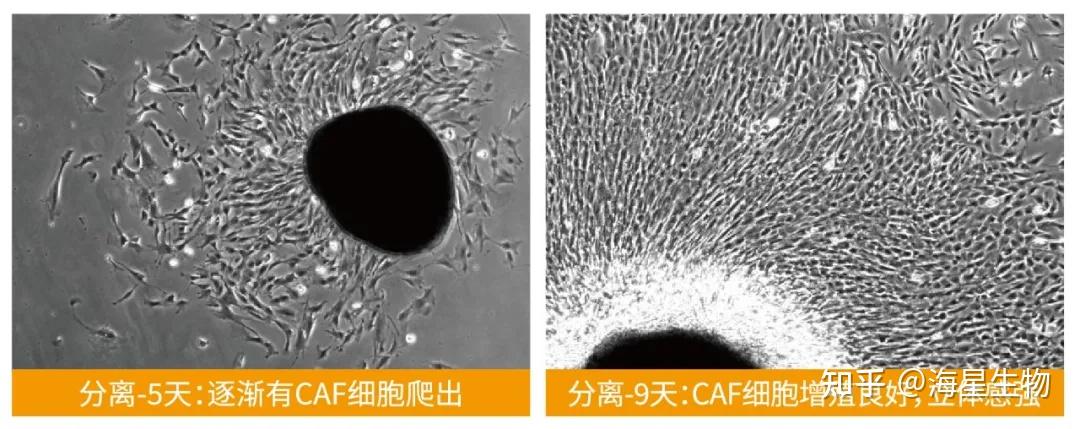 HyCyte®原代细胞预筛选胎牛血清S005—专为原代细胞设计 - 知乎
