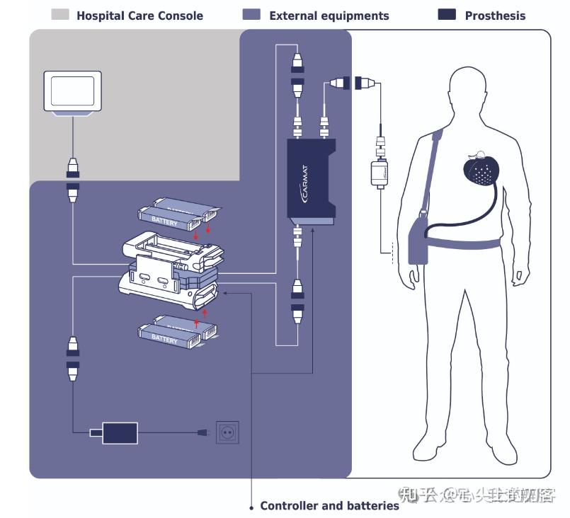 全人工心脏TAH：与著名外科医生一起探索心脏移植技术的未来 - 知乎