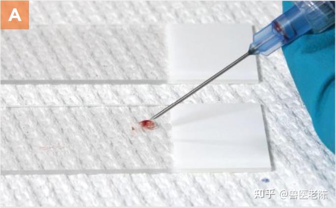 用细针活检法获取细胞学样本 - 知乎