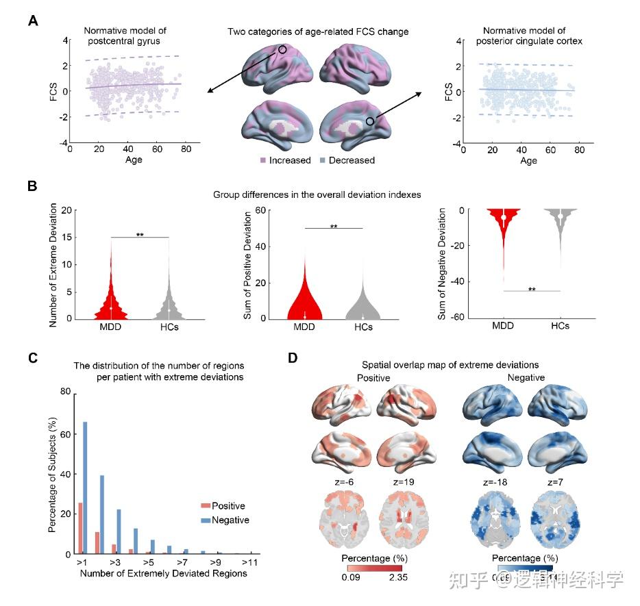 Biol Psychiatry︱北师大夏明睿课题组与合作者揭示抑郁症神经生物学亚型 - 知乎