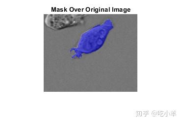 MATLAB图像处理：49：使用边缘检测和形态学检测细胞