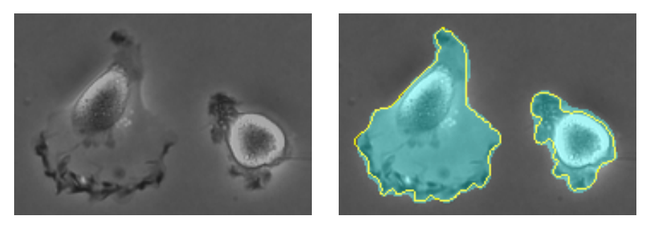U-Net 源码解读 - 知乎
