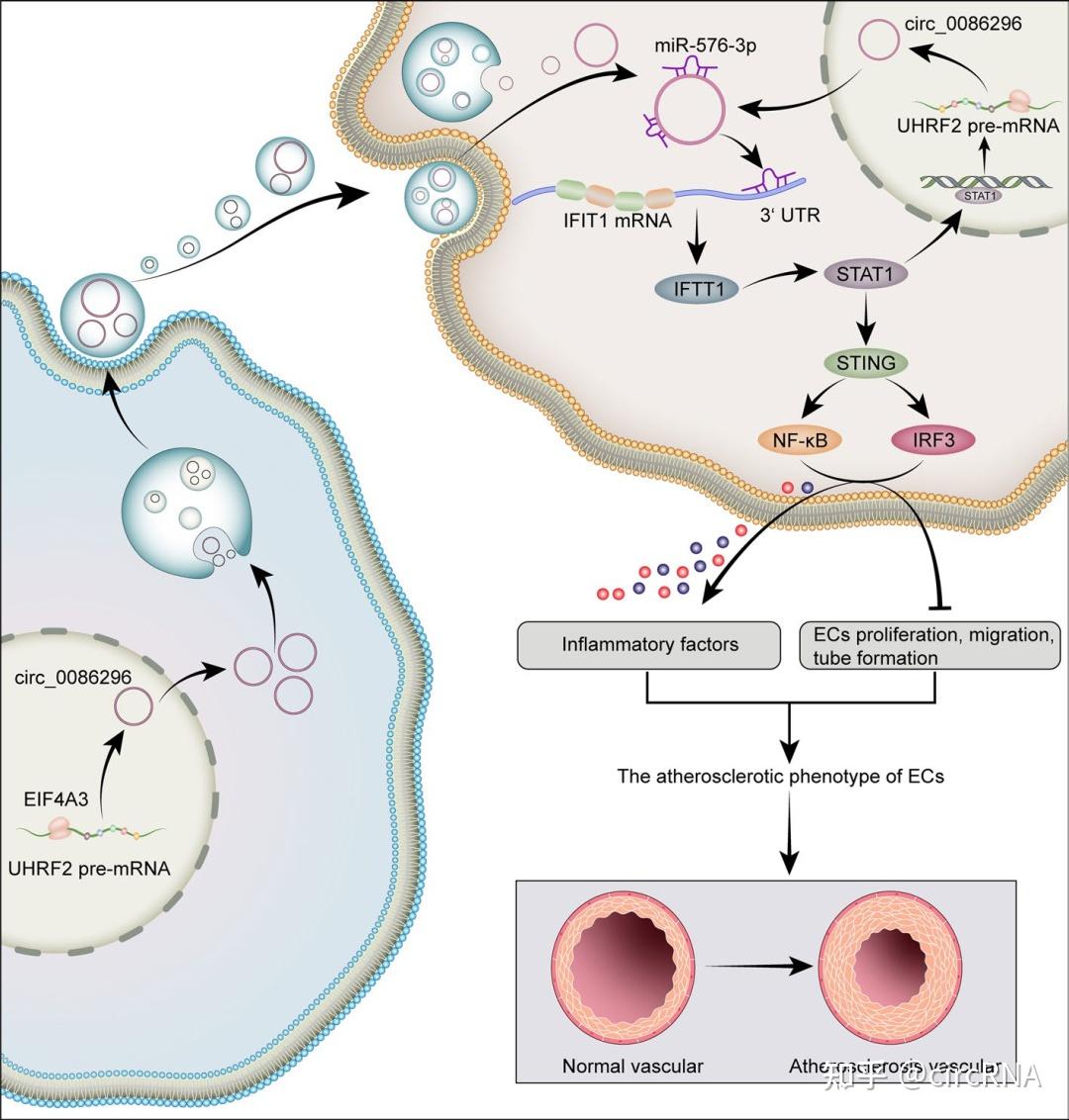Cell Mol Biol Lett | 蒋利与邱朝晖发现circ_0086296参与动脉粥样硬化作用机制 - 知乎