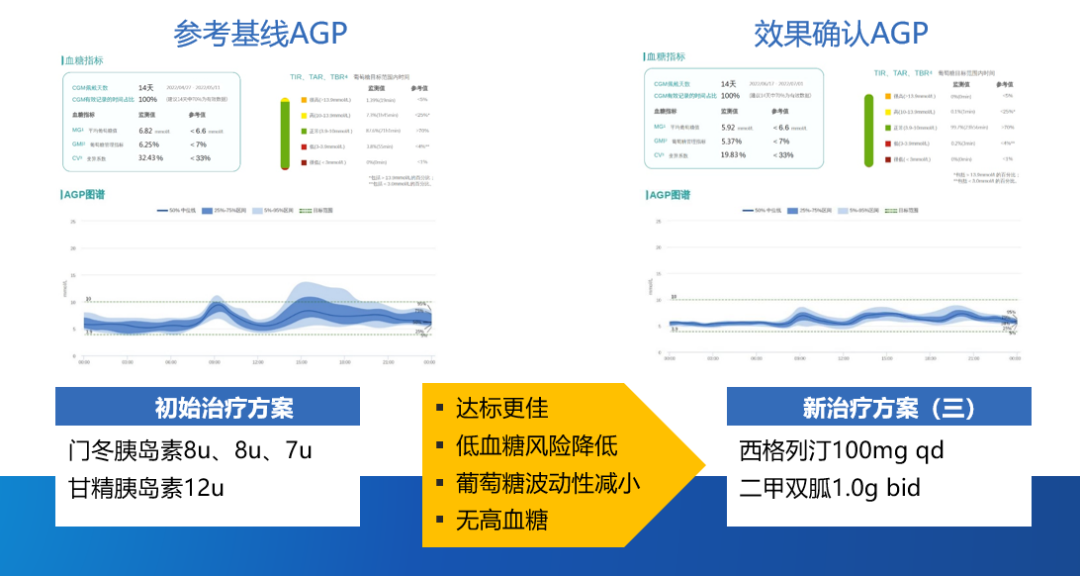 全面解读血糖数据，内分泌医生都要了解的 AGP 知识！ - 知乎