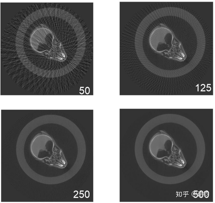 现代医学成像（3）——CT（基本原理与图像重建） - 知乎