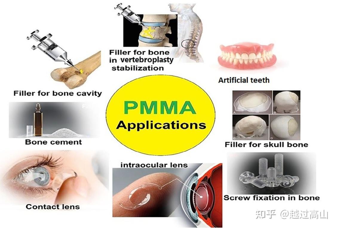 医用材料专刊（七）：聚甲基丙烯酸甲酯（Polymethyl Methacrylate，PMMA） - 知乎